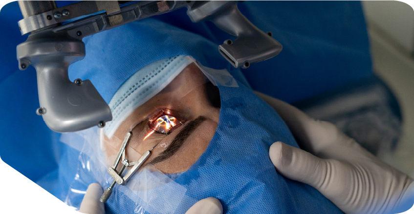 Cirugía Refractiva LASIK y Cirugía Láser de Ojos en Medellín